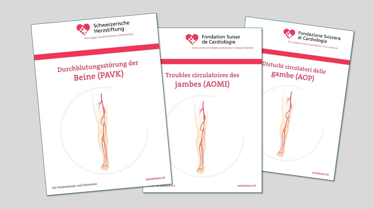 For Patients | Swissvascularmedicine
